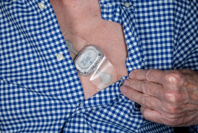 ECG Holter Monitoring for Long-Term Arrhythmia Management - Check your ...